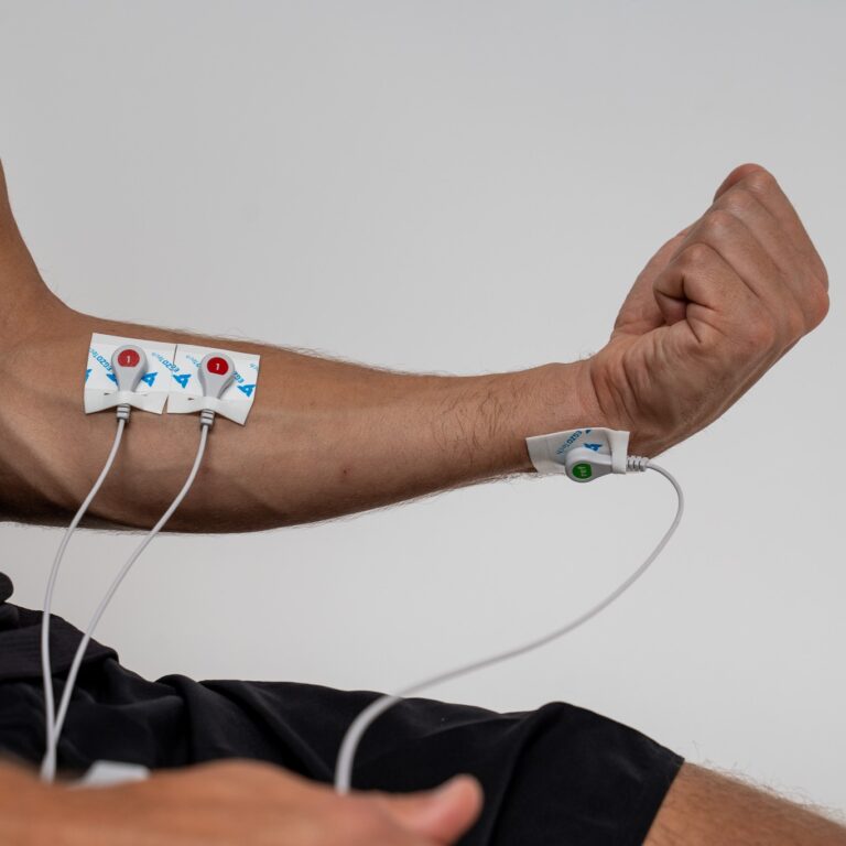 Electrodes placement – upper limb – EGZOTech – Empowering physiotherapy